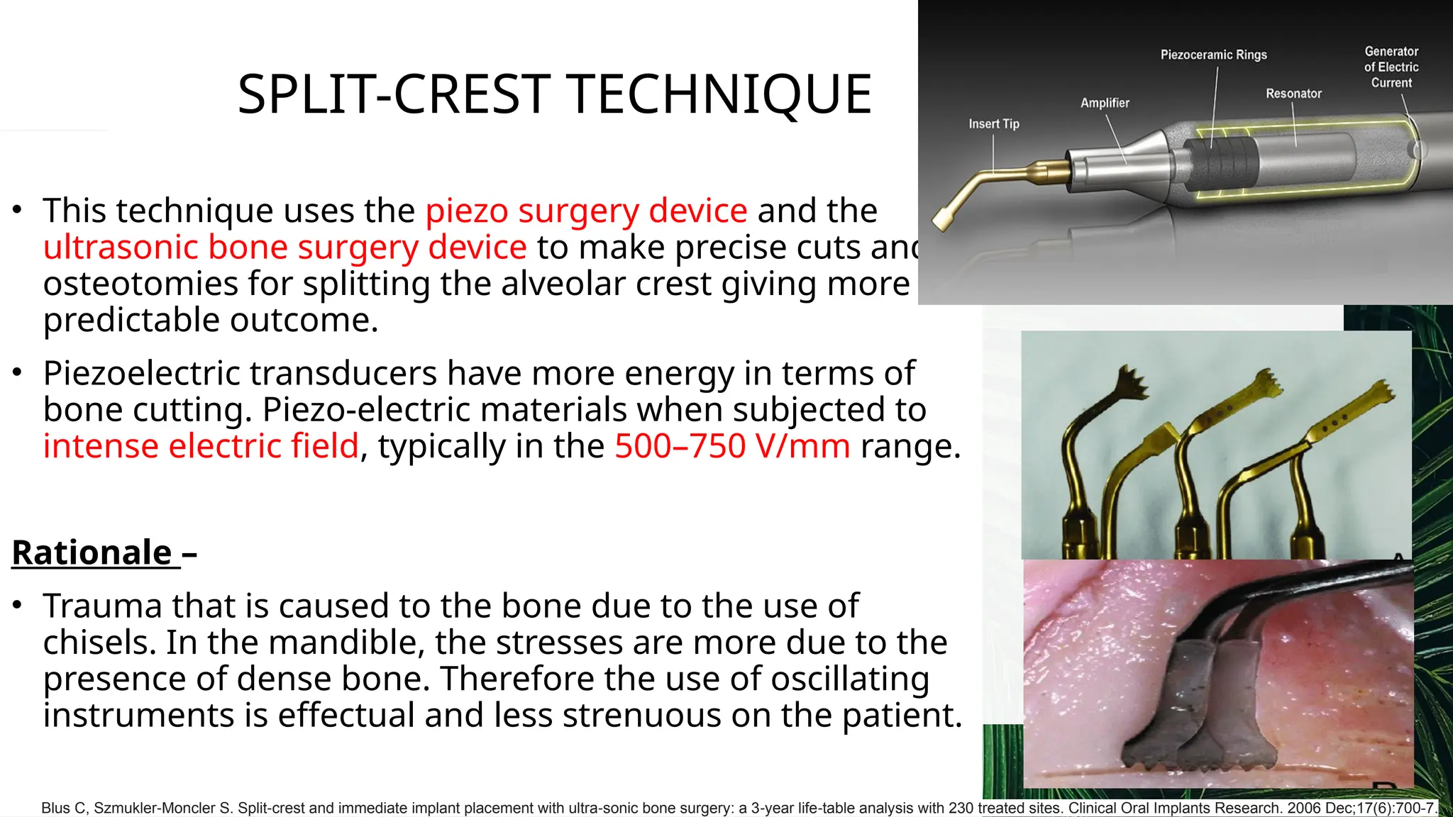 Ridge Split Techniques in Prosthodontics: Enhancing Alveolar Ridge for ...