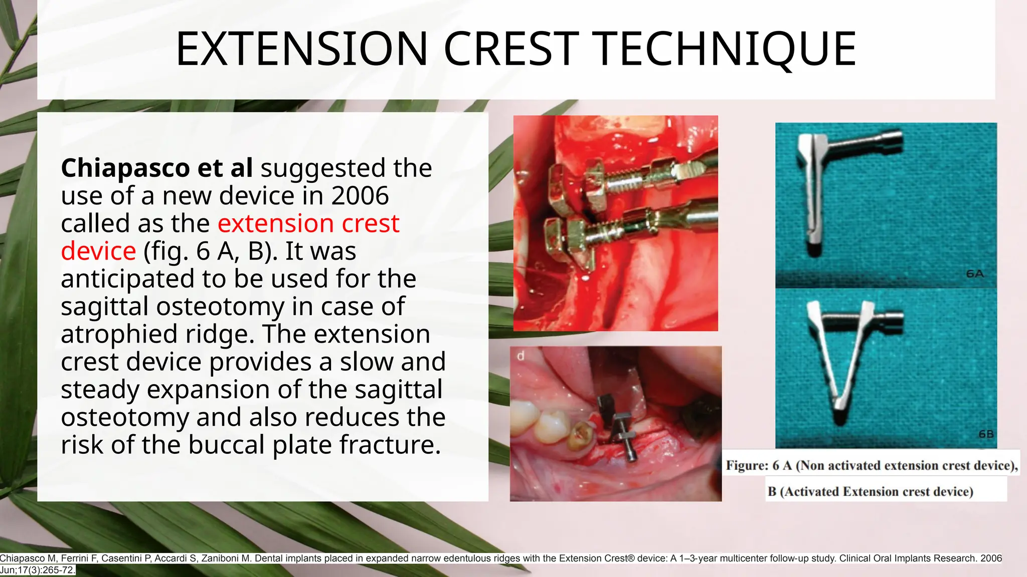 Ridge Split Techniques in Prosthodontics: Enhancing Alveolar Ridge for ...