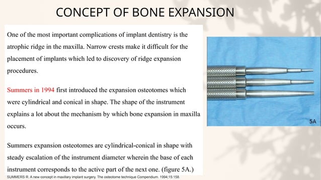 Ridge Split Techniques in Prosthodontics: Enhancing Alveolar Ridge for ...