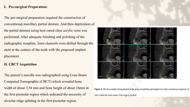 Ridge Split Techniques in Prosthodontics: Enhancing Alveolar Ridge for ...