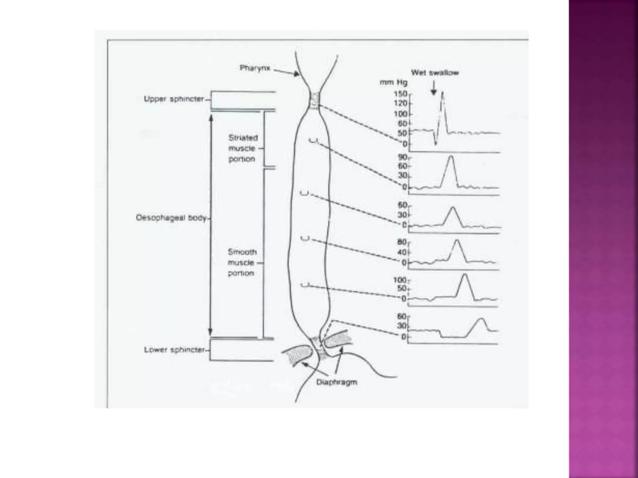 Esophagus : Benign and Malignant diseases | PPTX
