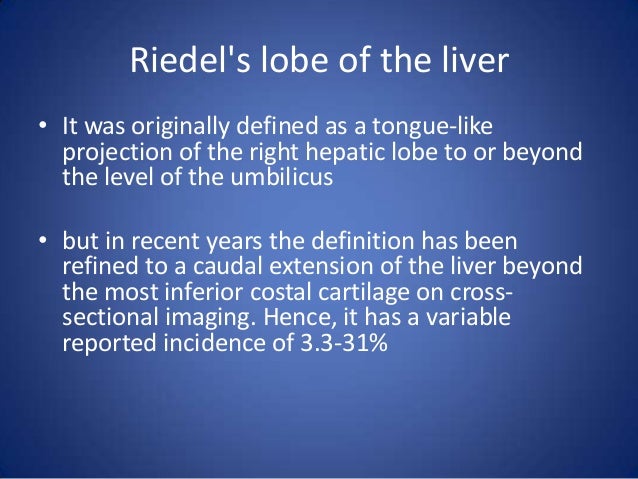 Riedel’s lobe of liver