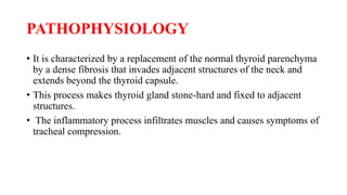 Riedel thyroiditis | PPT
