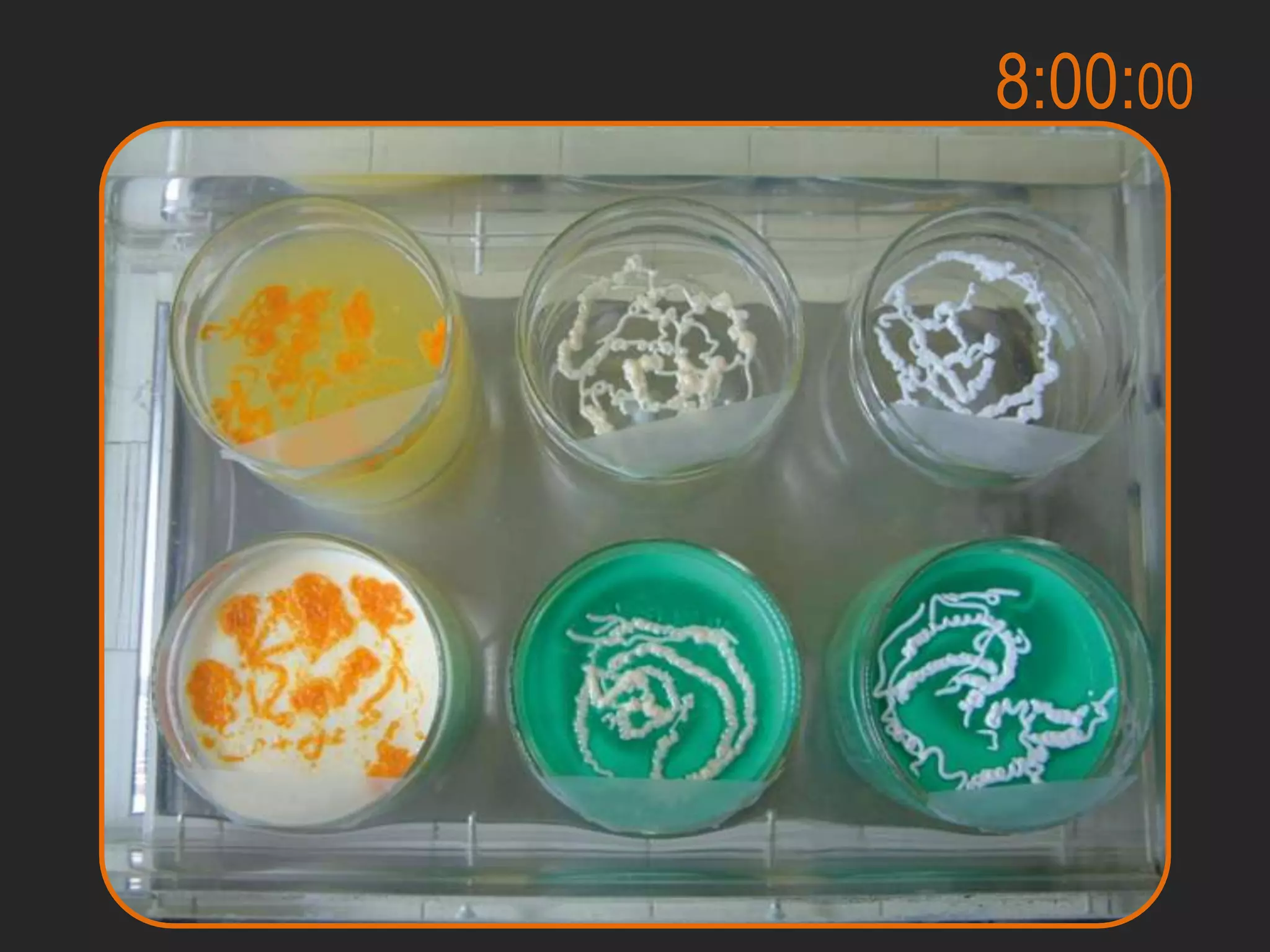 Rifaximin - Fatro worldwide exclusive antibiotic | PPTX