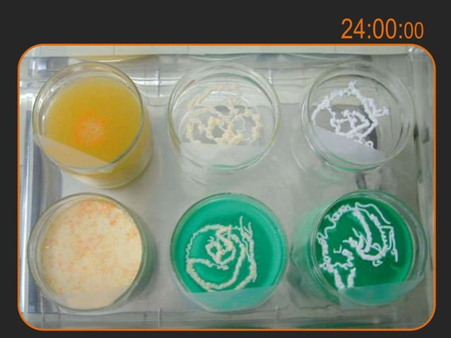 Rifaximin - Fatro worldwide exclusive antibiotic | PPTX