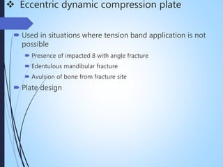 Rigid internal fixation in oral surgery | PPTX