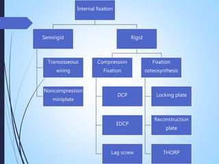 Rigid internal fixation in oral surgery | PPTX