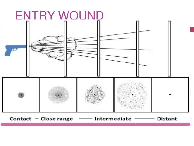 Rifled weapon injuries