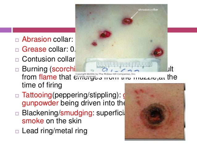 Rifled weapon injuries