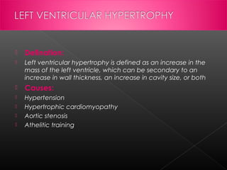 Right and left ventricular hypertrophy | PPT