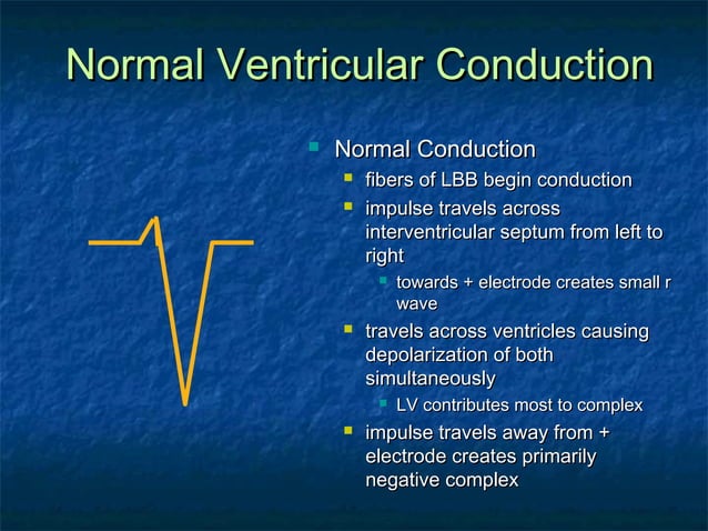 Right bundle branch block | PPT