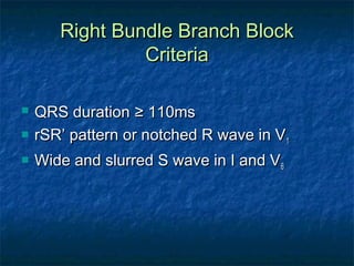 Right bundle branch block | PPT