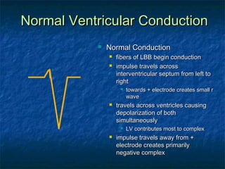 Right bundle branch block | PPT