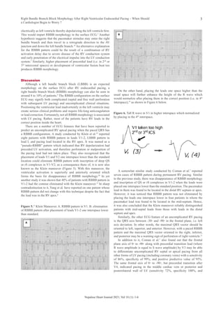 Right bundle branch block morphology after right ventricular ...