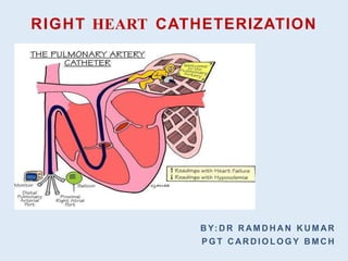 RIGHT HEART CATHETERISATION 2.pptx