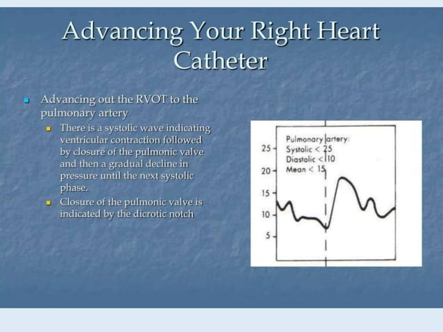RIGHT HEART CATHETERISATION 2.pptx