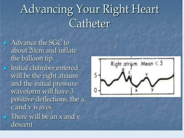 RIGHT HEART CATHETERISATION 2.pptx