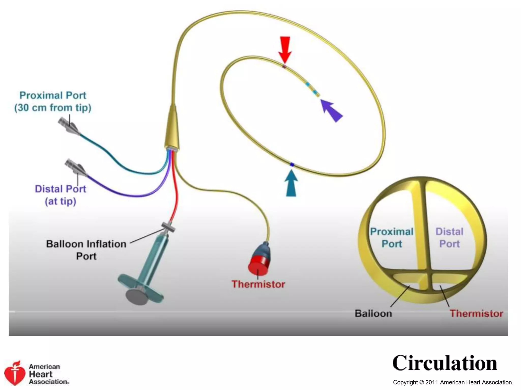 RIGHT HEART CATHETERISTION 1.ppt