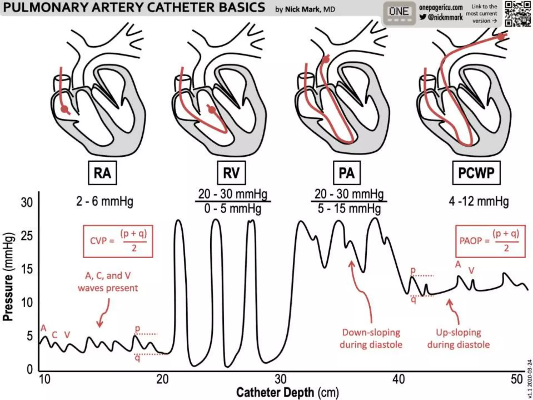 RIGHT HEART CATHETERISTION 1.ppt