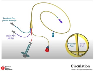 RIGHT HEART CATHETERISTION 1.ppt