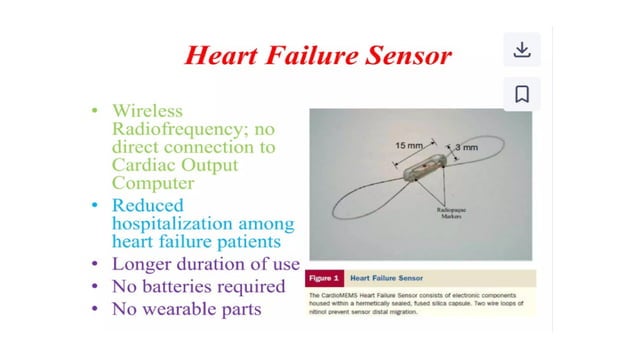 RIGHT HEART CATHETERIZATION (RHC) STUDY.pptx