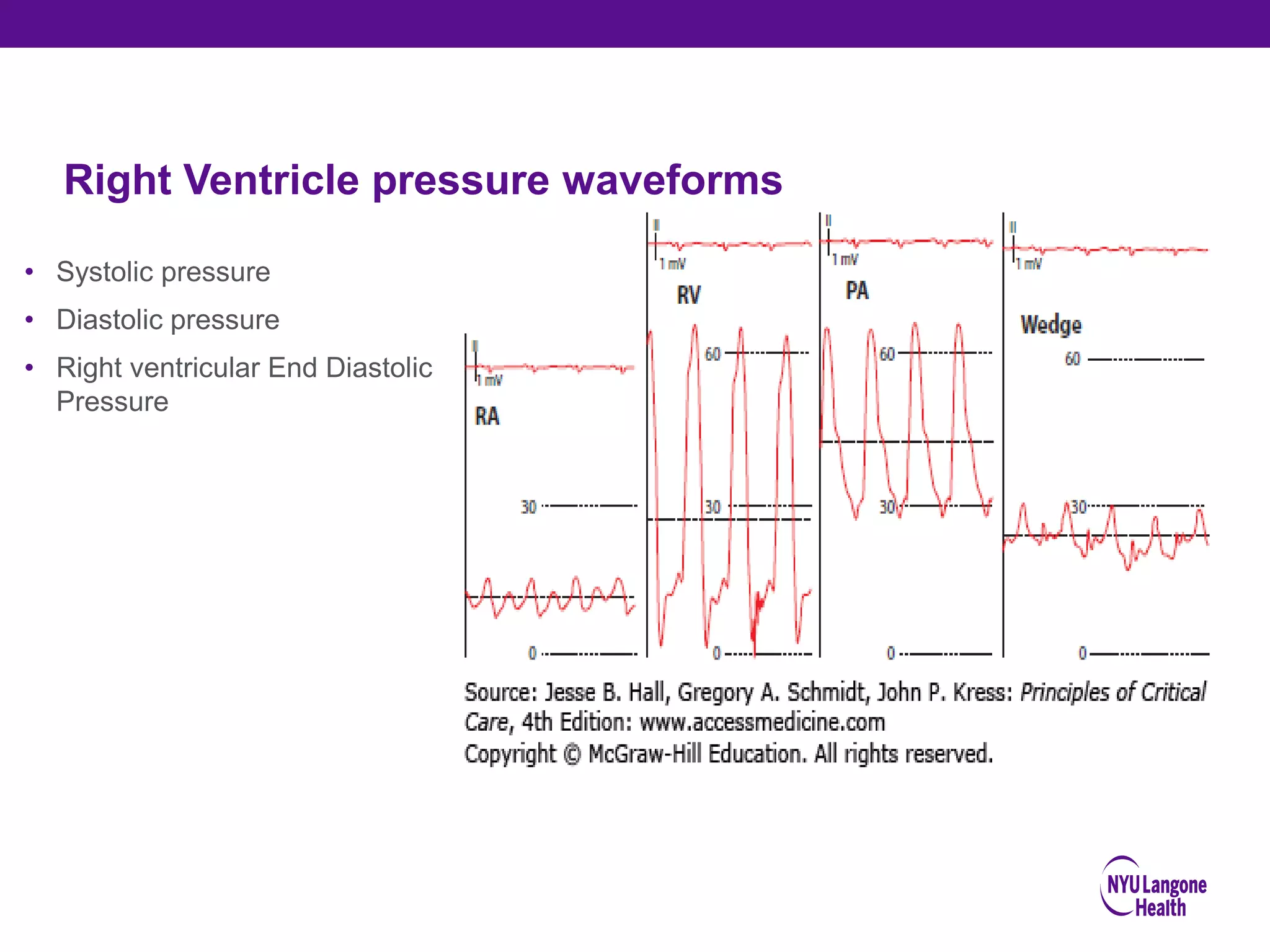 Right heart cath hemodynamics2.pptx