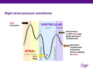 Right heart cath hemodynamics2.pptx