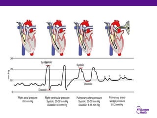 Right heart cath hemodynamics2.pptx