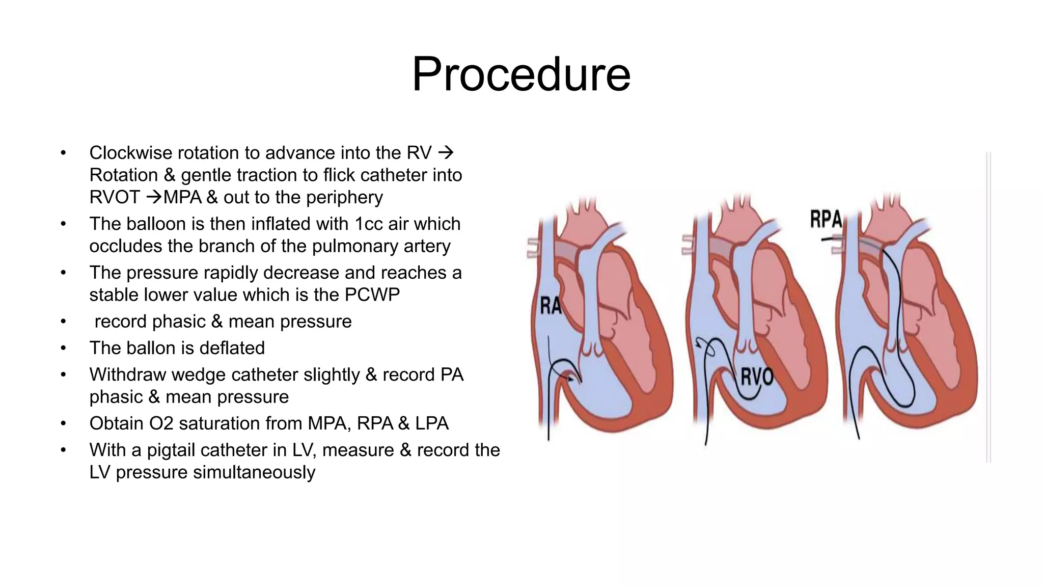 Right heart cathterization AL-AMIN.pptx