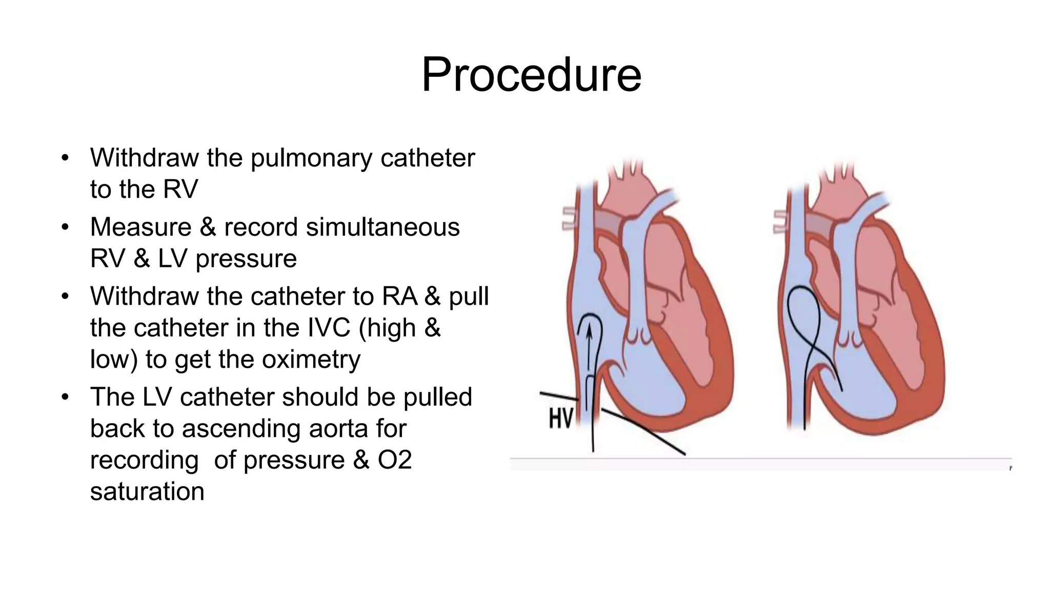 Right heart cathterization AL-AMIN.pptx