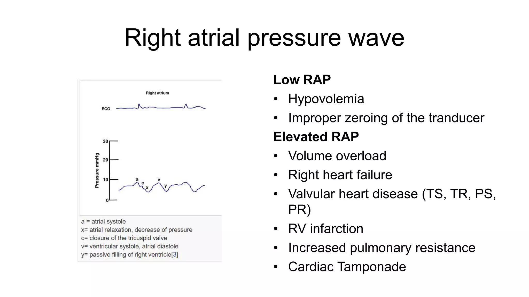 Right heart cathterization AL-AMIN.pptx