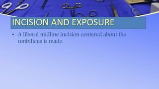Right hemicolectomy | PPTX