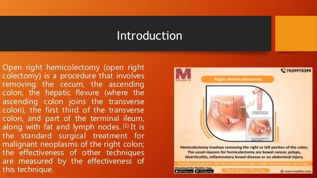 right hemicolectomy.pptx