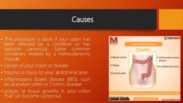 right hemicolectomy.pptx