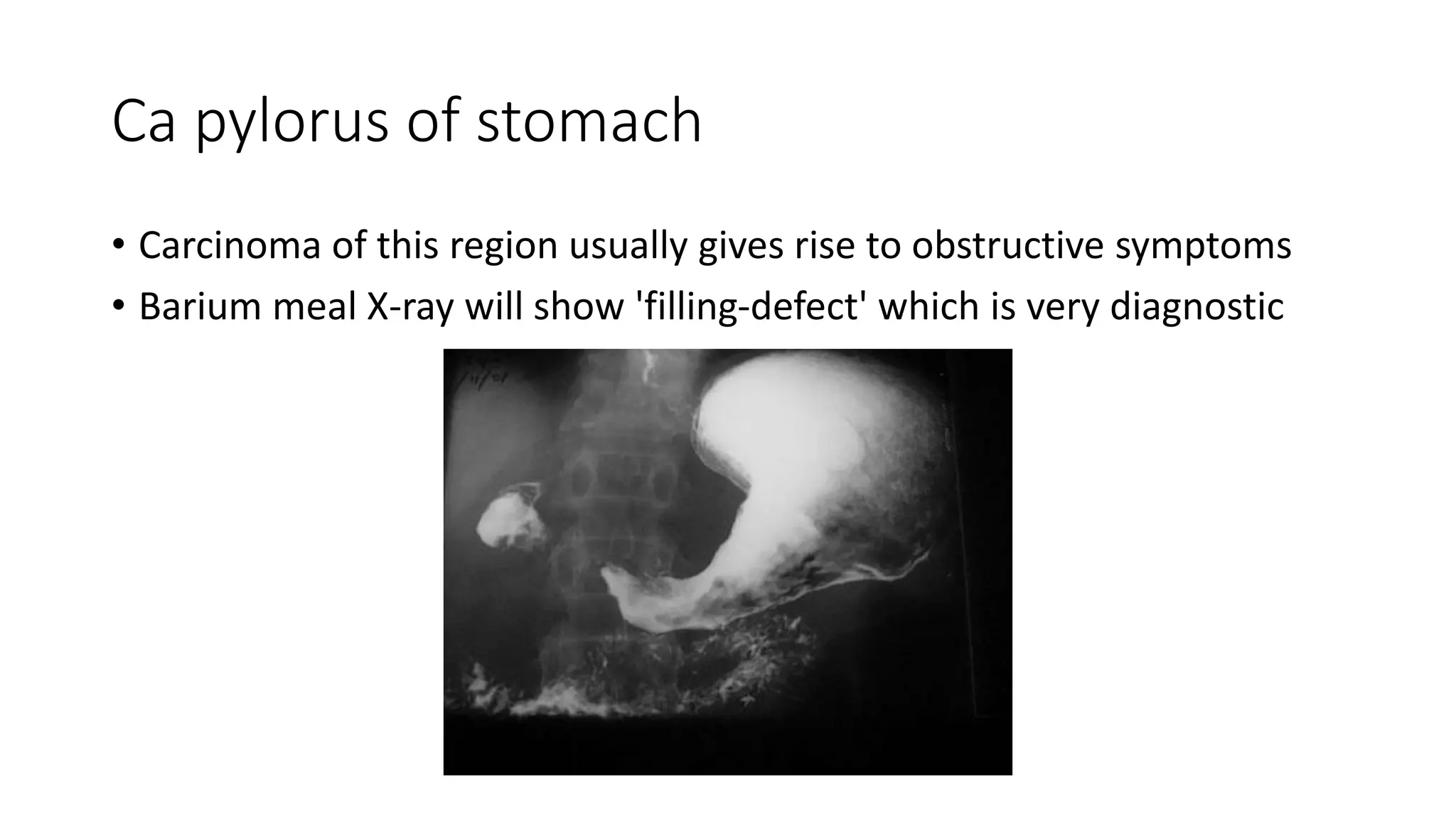 Right Hypochondrial Masses.pptx