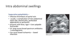 Right Hypochondrial Masses.pptx