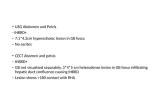 Right Hypochondrial Mass with Obstructive Jaundice.pptx
