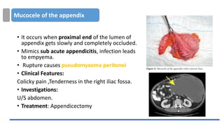 Right iliac fossa mass | PDF