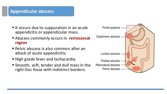Right iliac fossa mass