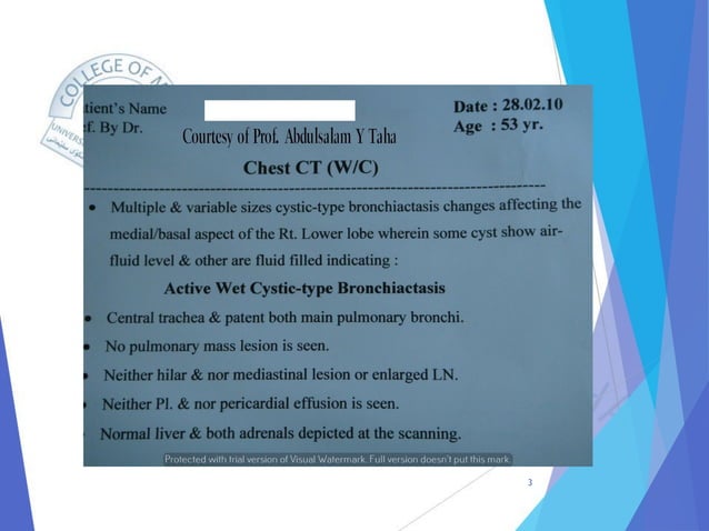 Right Lower Lobe Bronchiectasis.pdf
