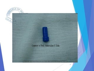 Right Main Stem Bronchus Foreign Body with Subcutaneous Emphysema.pdf