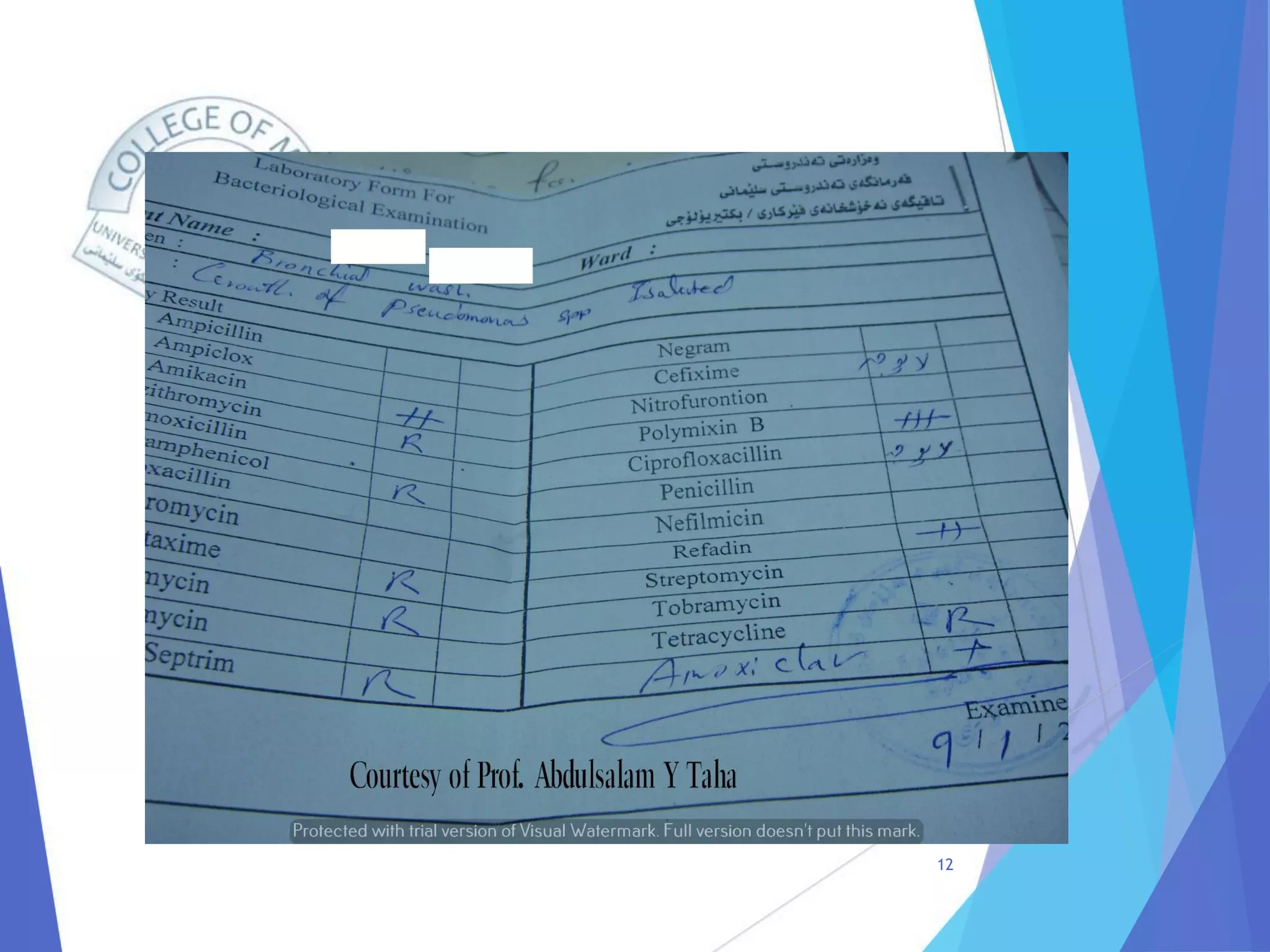 Right Middle and Lower Pulmonary Bilobectomy for Bronchiectasis.pdf