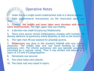 Right Middle and Lower Pulmonary Bilobectomy for Bronchiectasis.pdf