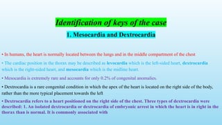 Right to Left Angina Yasser’s Syndrome (Swinging Yasser’s Central Heart ...