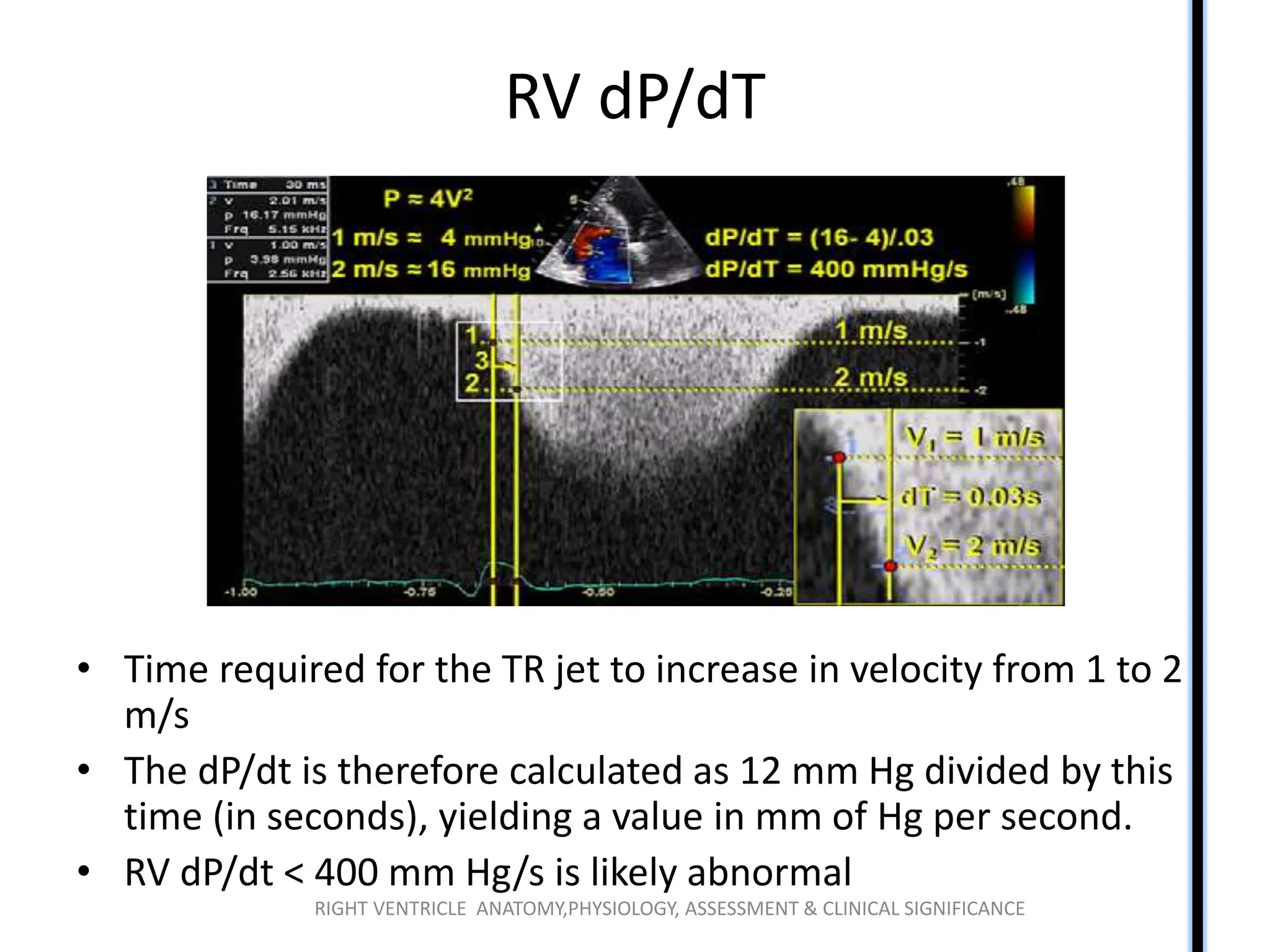 Right ventricle anatomy ,physiology and echo findings.ppt
