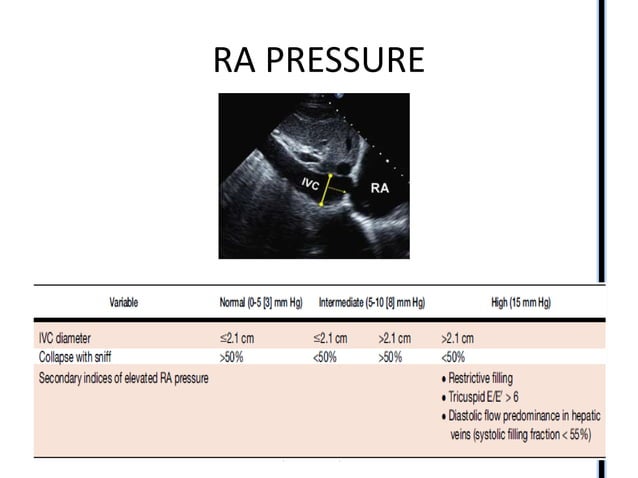 Right ventricle anatomy ,physiology and echo findings.ppt | Heart and ...