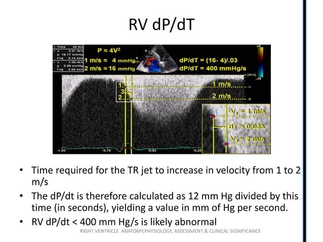 Right ventricle anatomy ,physiology and echo findings.ppt | Heart and ...