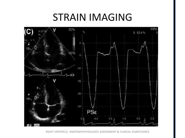 Right ventricle anatomy ,physiology and echo findings.ppt | Heart and ...