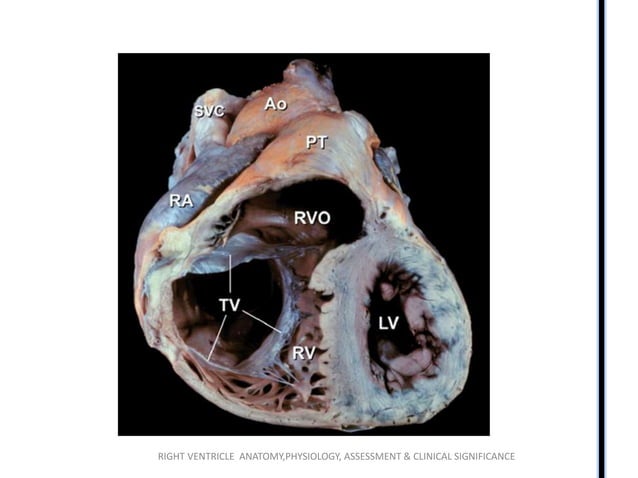 Right ventricle anatomy ,physiology and echo findings.ppt | Heart and ...
