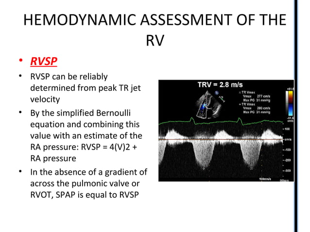 Right ventricle (RV) anatomy and functions